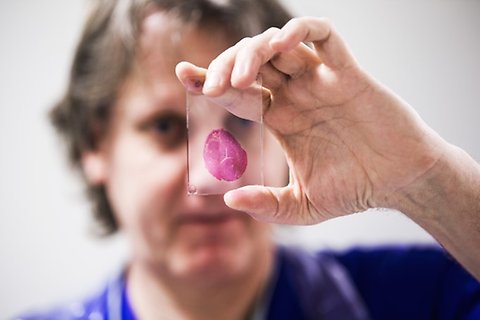 Biomedicinsk analytiker (BMA) - Region Värmland